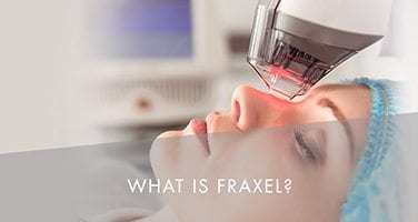What is Fraxel? - The Aesthetic Skin Clinic
