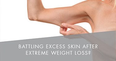 Battling Excess Skin After Extreme Weight Loss? - The Aesthetic Skin Clinic
